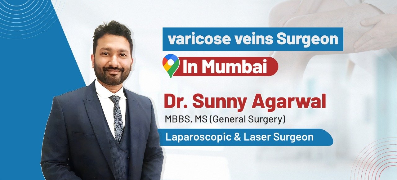 Expert varicose veins Surgeon in Mumbai | Dr. Sunny Agrawal